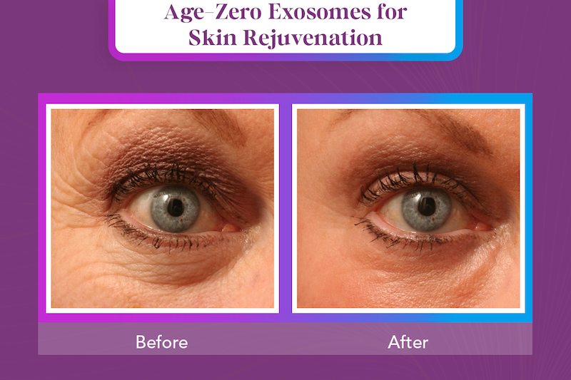 Exosomes & Stem Cell Treatments Gilbert, Chandler, & Mesa, AZ