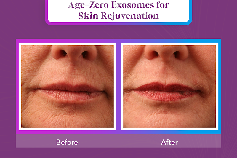 Exosomes & Stem Cell Treatments Gilbert, Chandler, & Mesa, AZ